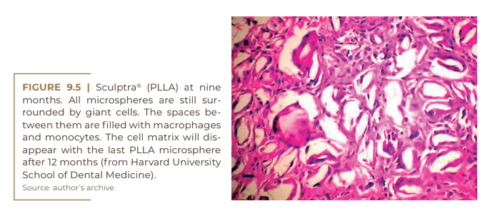 BIOSTIMULATORY EFFECTS OF MICROSPHERE INJECTIONS INTO OVERLYING SKIN ...